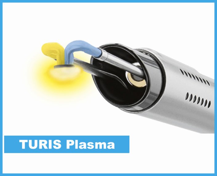 Εξάχνωση Προστάτη | TURIS Plasma - LASER Green light